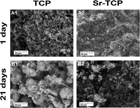 Sem Microstructure Of Tcp And Sr Tcp Cements After Soaking In Ringer