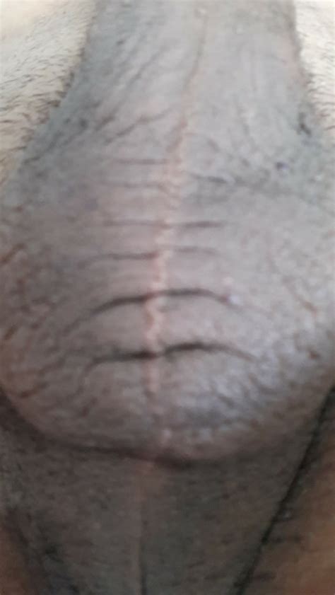 Superballs 13 Pics Xhamster