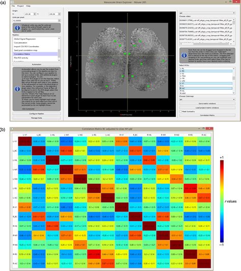 Mesoscale Brain Explorer A Flexible Python Based Image Analysis And