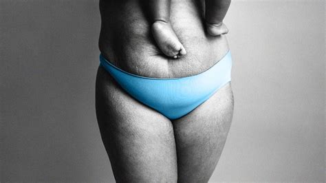 Postpartum Bleeding What To Expect