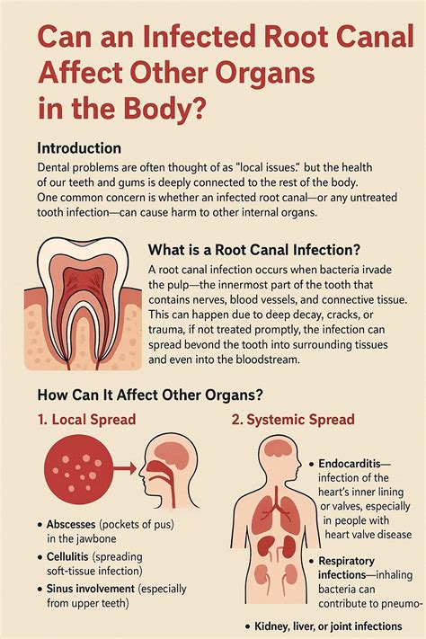 Root Canal Infection Causes Risks And Treatment Drhisana Abdul
