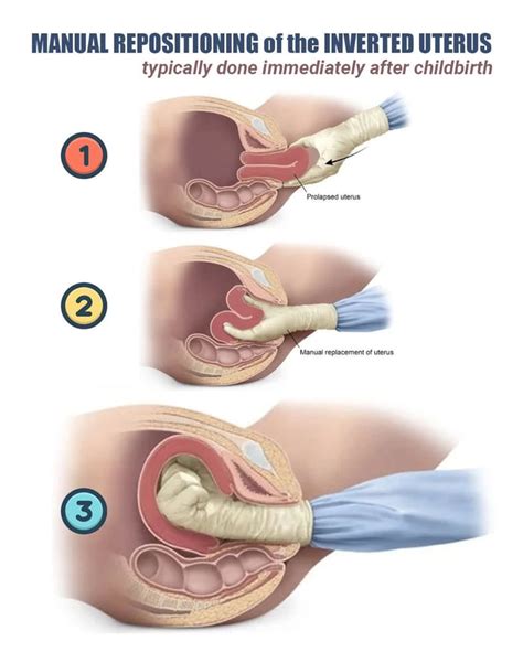 Flip It Back Like A Pro GAG