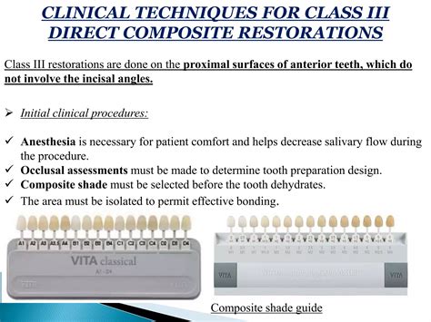 Composite Class 3 And Class 5 Pptx