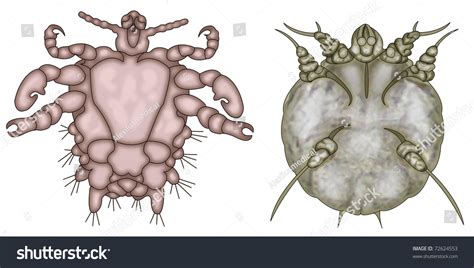 Illustration Two Parasites Belonging Human Scalp Stock Illustration 72624553 Shutterstock