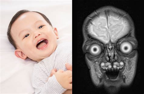 이거 악마 아닙니다 태아 초음파 대신 Mri 사진 찍은 부모 경악