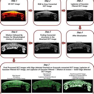 Stepwise Representation Of The Algorithm For Analyzing Enamel Loss And