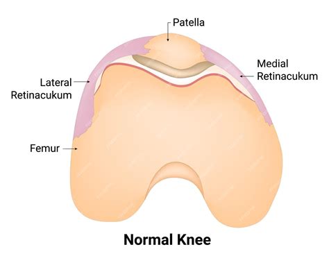 Premium Vector Normal Knee Patella Lateral Retinaculum Femur Medial