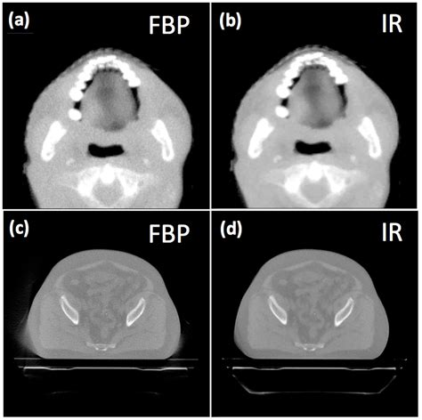 Reconstructed Images A Head Region Using Filtered Back Projection Download Scientific