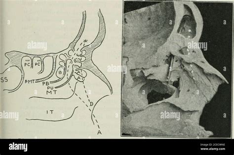 Cribriform Plate Hi Res Stock Photography And Images Alamy