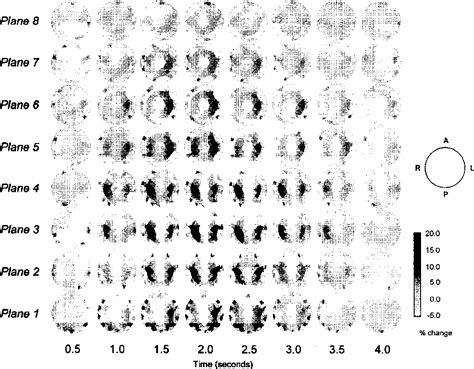 Figure 2 From Three Dimensional Electrical Impedance Tomography Of The