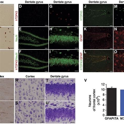 Restricted Expression Of Mutant Human Tdp 43 In Astrocytes In