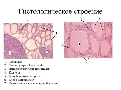 Рак щитовидной железы Online Presentation
