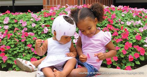 Cranial Orthoses And Orthotics In St Louis Orthotic And Prosthetic Lab Inc