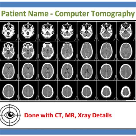 Patient Information Screen 4 Camera View Screen Camera View Screen Is