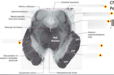 Midbrain Inf Colliculus Level Diagram Quizlet