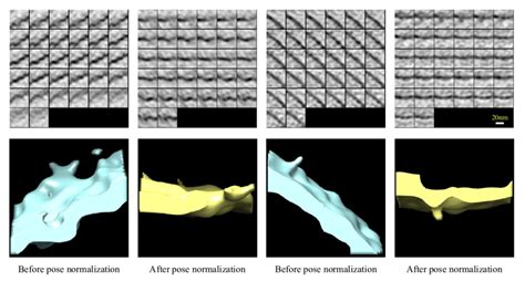 Examples Of Surface Small Subvolumes 2d Slices Before And After Pose Download Scientific