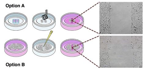 Cell Adhesion And Migration Assay Creative Diagnostics