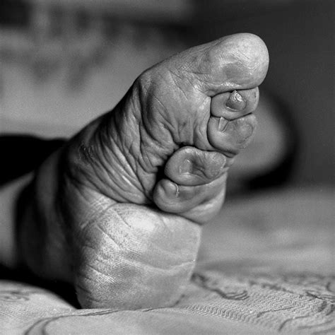 The Bizarre History Of Foot Binding By Yewande Ade History Street