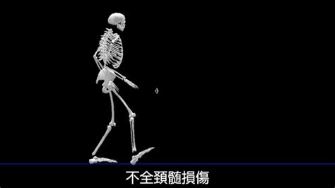 臨床実習のための歩行分析トレーニングブック on Vimeo