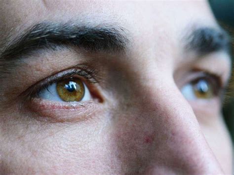 Multiple Sclerosis 10 Symptoms Of Multiple Sclerosis