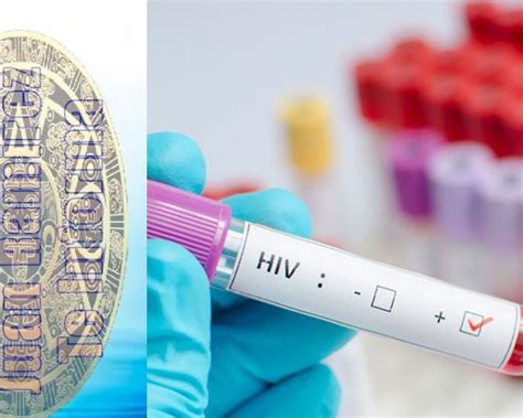 Conoce los síntomas y riesgos del Sida en las personas