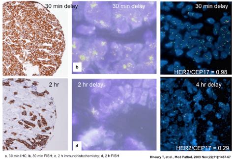 Time To Fixation Cold Ischemia Time Important For Preservation Of Download Scientific