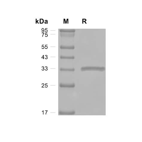 Pngase F蛋白 F Meningosepticum His Mce