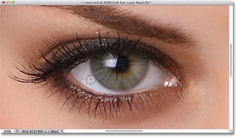 Just Noticed A Tiny Black Dot Right Outside The Edge Of My Iris Askdocs