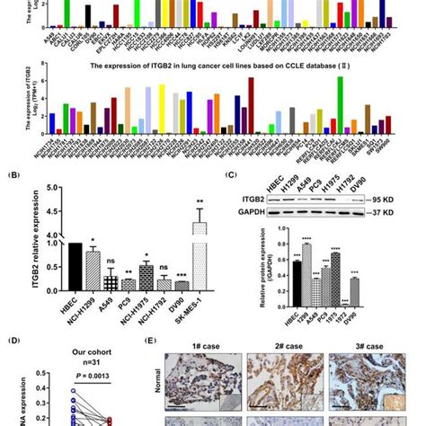 Itgb2 Expression Was Downregulated In Nsclc And Its Low Levels Were