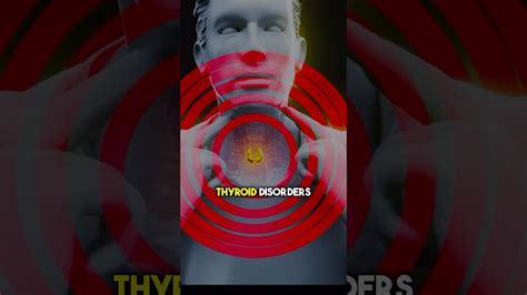 Hypothyroid Vs Hyperthyroid Hypothyroid Hyperthyroid Thyroid Health