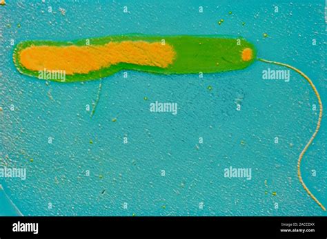 False Colour Transmission Electron Micrograph Of The Bacterium Vibrio Cholerae Gram Negative