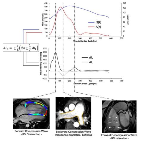 Wave Intensity Analysis Spectrum Sampled At The Main Pulmonary Mid