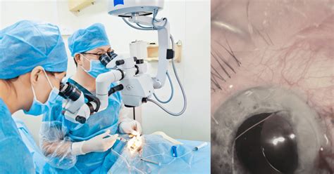 Innovation In Medical Optics Transforming Healthcare