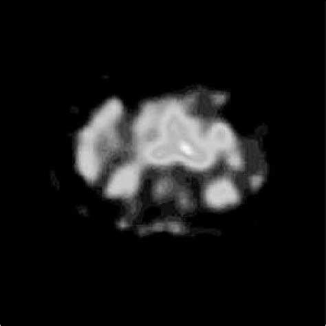 Figure 1 From Method For Fast Ct Spect Based 3d Monte Carlo Absorbed Dose Computations In