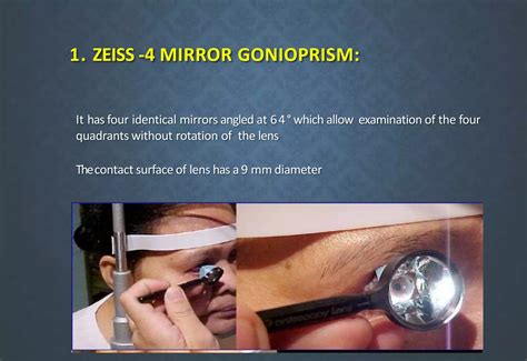 Gonioscopy Pptx