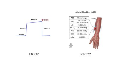 Benefits Of Etco2 Over Paco2 Brainiac Healthcare The Worlds First
