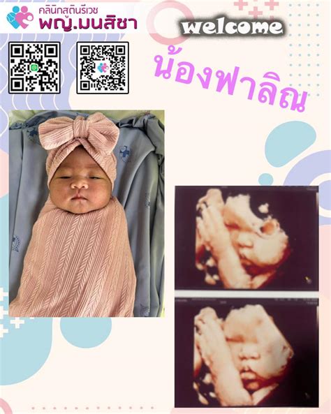 🎉 ยินดีต้อนรับ “น้องฟาลิณ” นะคะ 🎉 🎀 อัลตราซาวน์ 3 มิติ 4 มิติ ทำให้พ่อแม่สามารถเห็นลูกน้อยได้