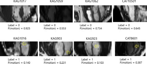 Representative Examples Of Incorrect Predictions In The Estimated Long