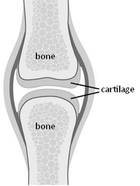 Cartilage Bone