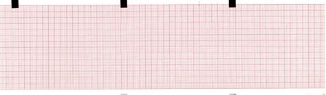 Ecg Paper 80mm X 90mm X 360sheet Works For Hellige Desertcart India