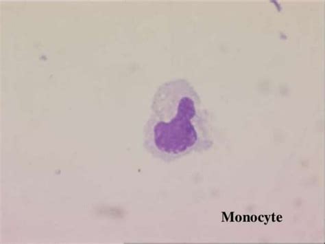 Cerebrospinal Fluid Csf Examination Under Microscope Ppt