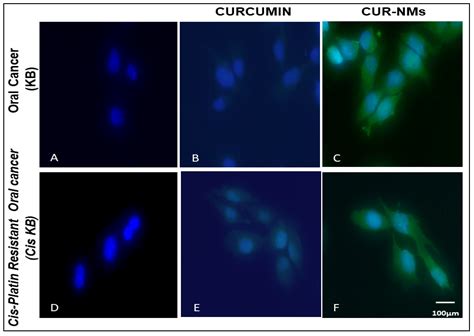 Jfb Free Full Text Curcumin Encapsulated Nanomicelles Improve Cellular Uptake And