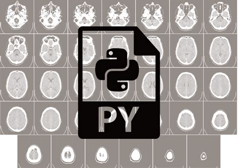 【python】 dicomフォーマット（医療用画像）を読み込む方法 ひつじ工房