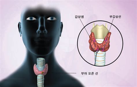 Health Condition Symptoms Causes Treatment And More
