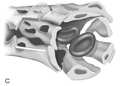 Sinusoid Capillary Labeling Diagram Quizlet