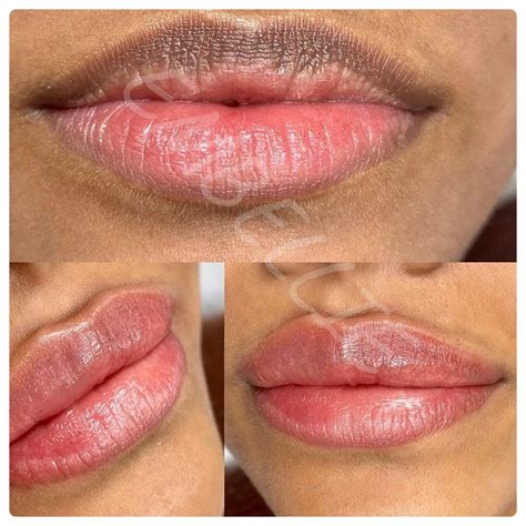 Extreme Pink Lip Brightening Balm Solution Permanent Pink Lip Dark Lip