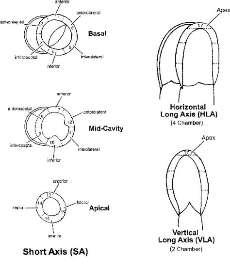 Figure 1 From Standardized Myocardial Segmentation And Nomenclature For