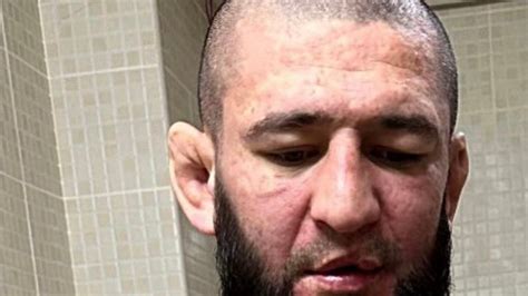 Ufc Khamzat Chimaev Shares Shocking Illness Photos Before Kamaru Usman