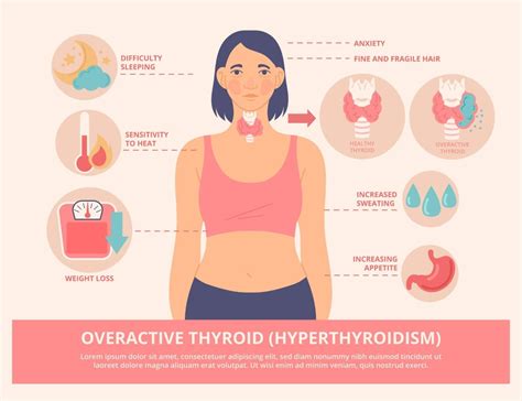 Hyperthyroidism Treatment And Diagnosis Medication Symptoms