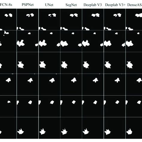 Segmentation Results Of Models Using Focal Loss Download Scientific